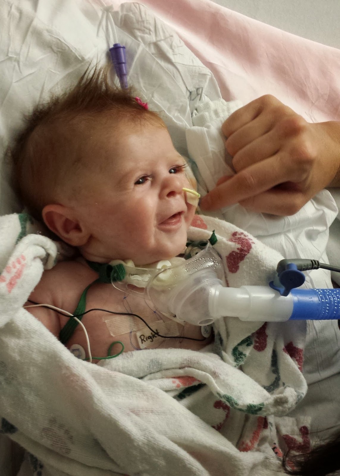 Friends of 4p+: Ellie