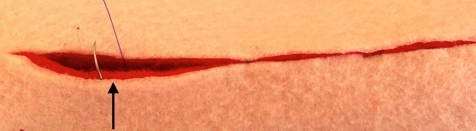 Veterinary Key Points: Closure of Elliptical Incisions in Dogs: The ...