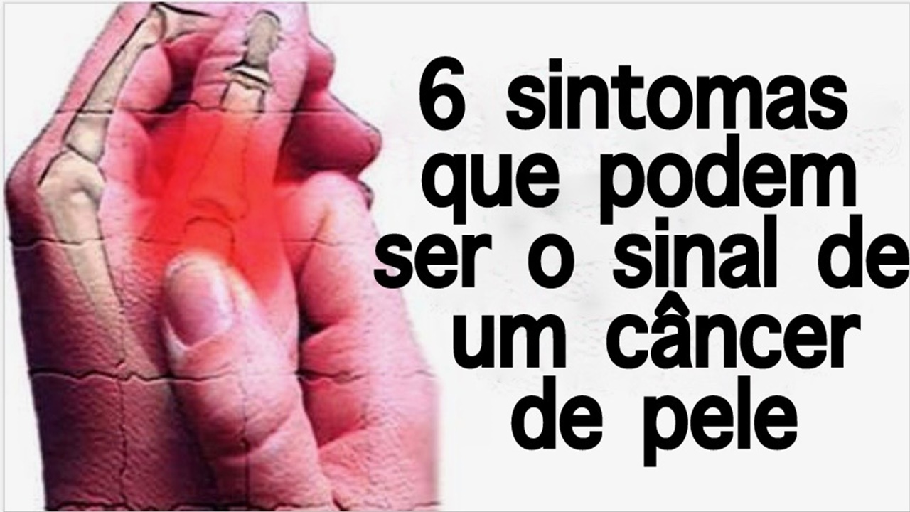 Conheça os Sintomas que Pode Ser Um Câncer de Pele - Blog Universo Feminino