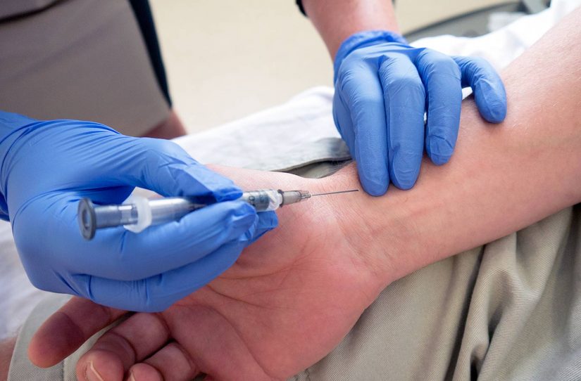 Gasometría arterial.