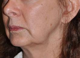 Rhonda Talbot World: Scarlett Johannson's Breasts Can Be Yours