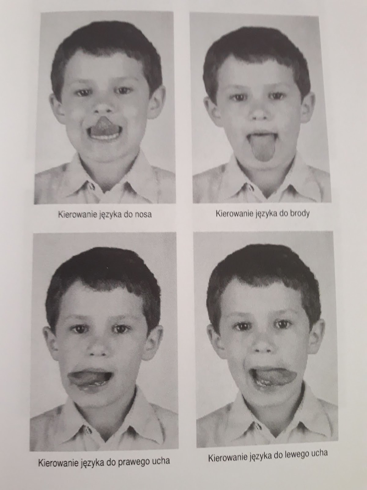 Dyslalia ankyloglosyjna? Co to znaczy?