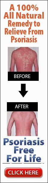 Psoriasis Natural Treatment BLOG: What Does Psoriasis Look Like?