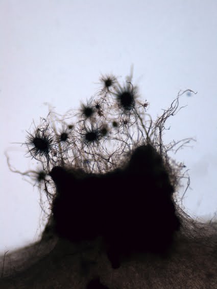 Fun With Microbiology (What's Buggin' You?): Chaetomium Species