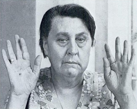 Amazing wonderful real stigmata cases - twenty ranking