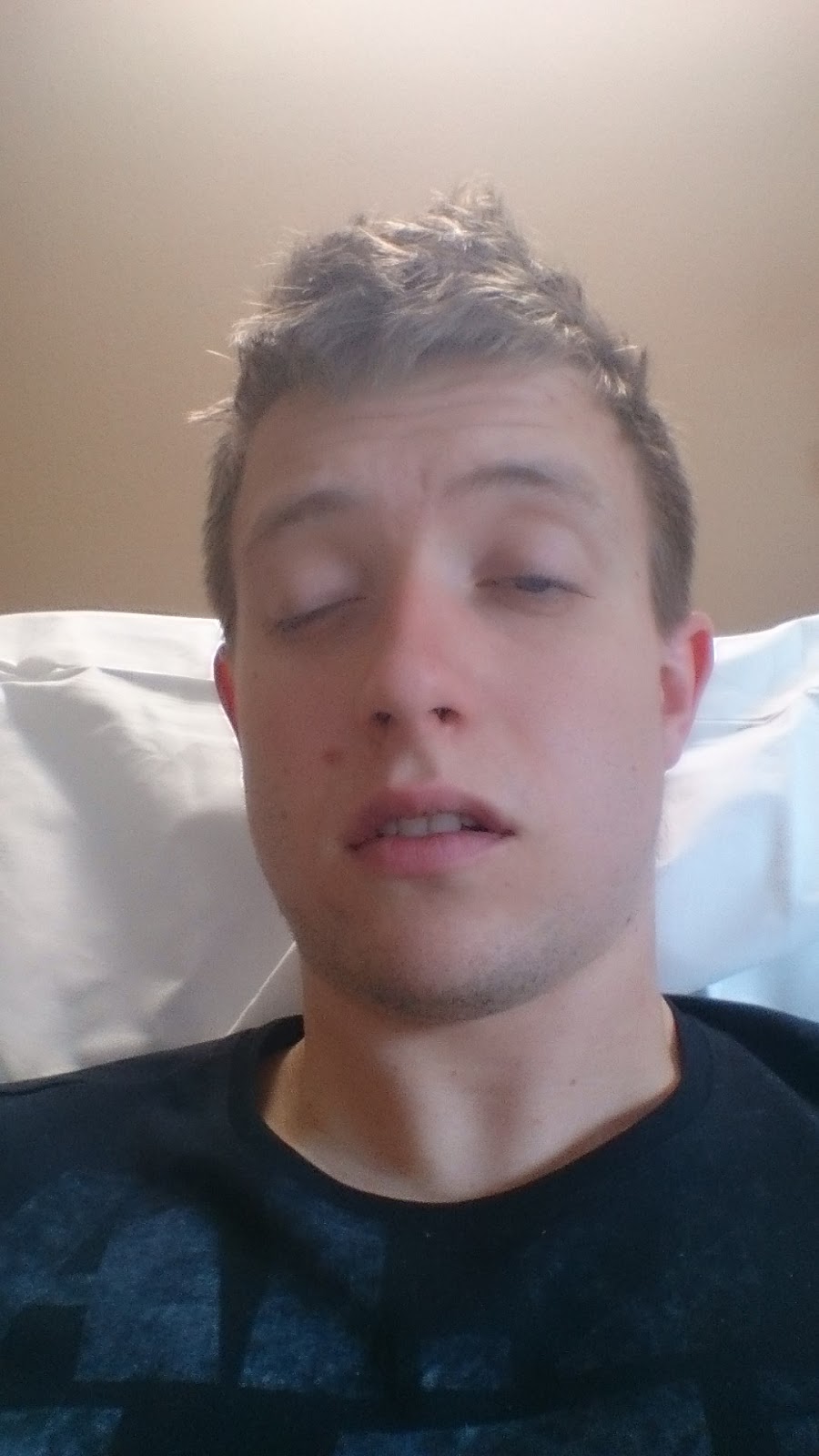 life of an amputee: unveiling the stump!