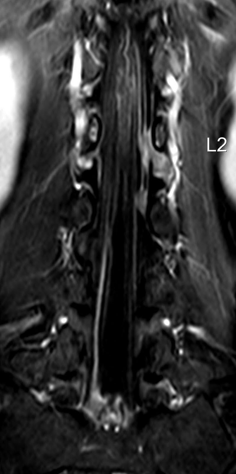 MY E-RADIOLOGY CASES: November 2011