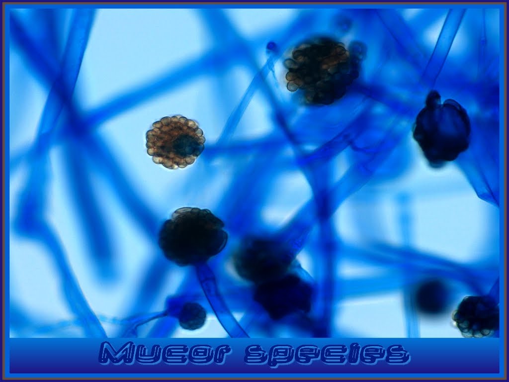 Fun With Microbiology (What's Buggin' You?): Mucor Species
