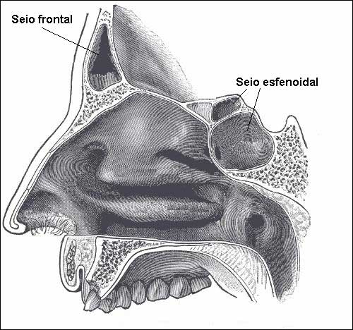 Resumo: Seios Paranasais - Radiologia e Concursos