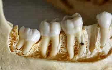 The Teeth-Ing Troubles: Unerupted /Impacted teeth
