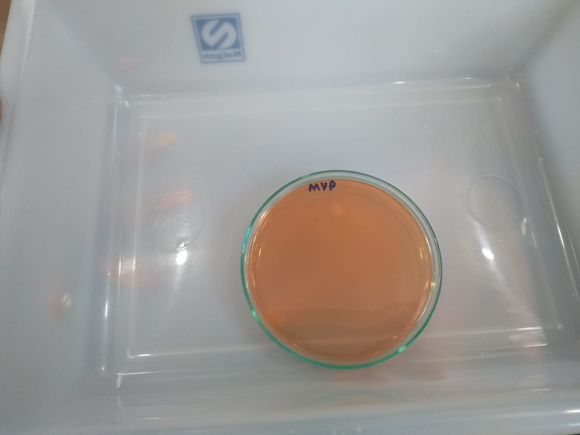 Microbiologia IFRJ - Campus Rio de Janeiro: Quatro bactérias em cinco ...