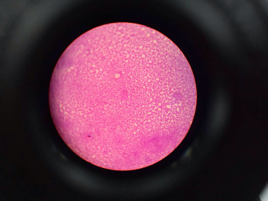 Experiment 6: Preparation of bacterial smear, Experiment 7: Simple ...