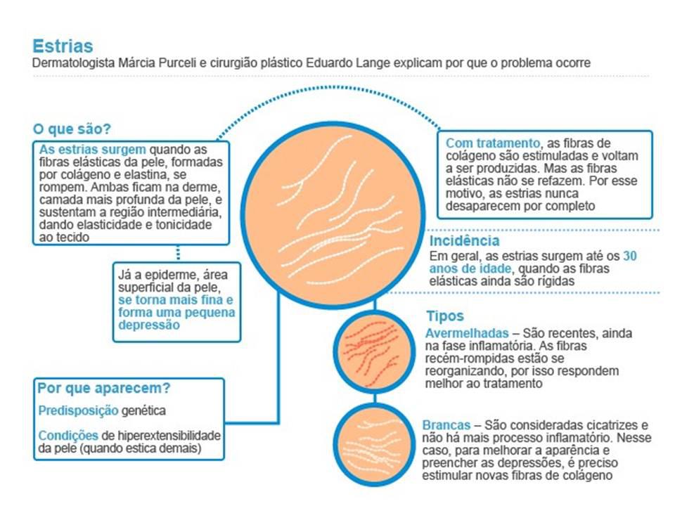 Viva Saudável: As temidas ESTRIAS!