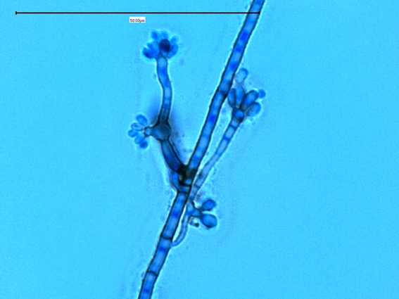Fun With Microbiology (What's Buggin' You?): Fonsecaea pedrosoi/monophora