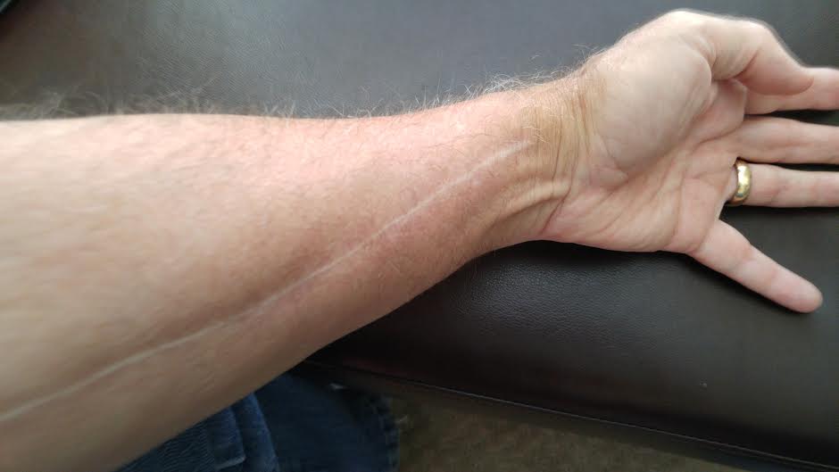 VIA SALUTIS - The Way of Salvation: SCARS, WOUNDS, AND HEALING