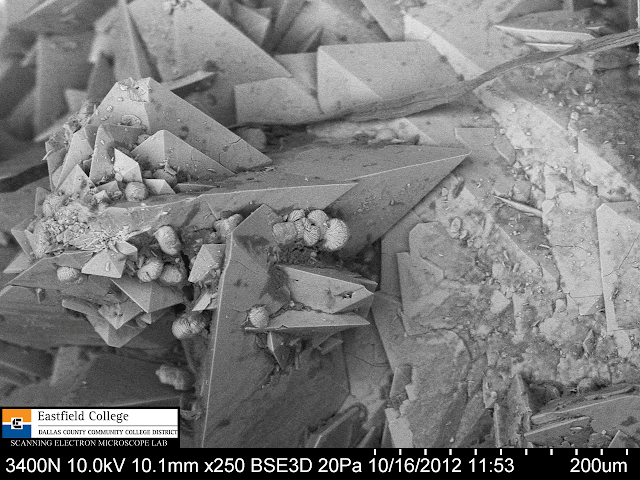 Scanning Electron Microscope Blog: A Kidney Stone - OUCH!!