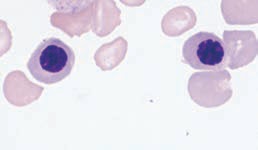 Orthochromic Normoblast ~ Hematology Lectures