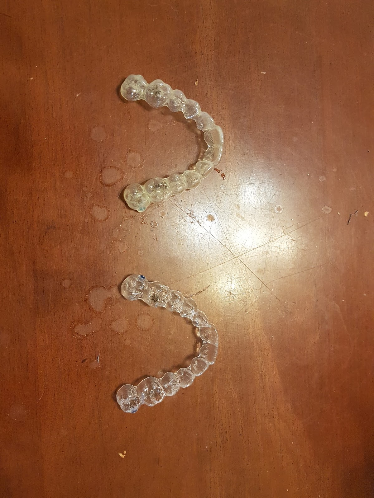 My Invisalign Blog: Tray 2 - Hour 16