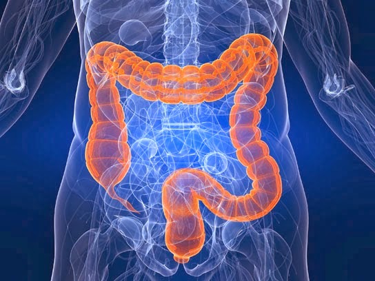 ¡Qué inflamado está esto!: Colitis