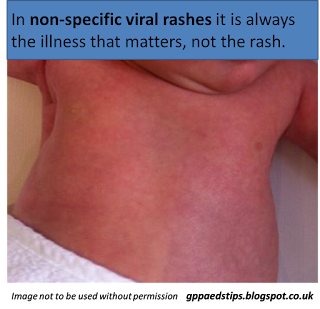 Paediatrics for Primary Care (and anyone else): Rashes in children ...
