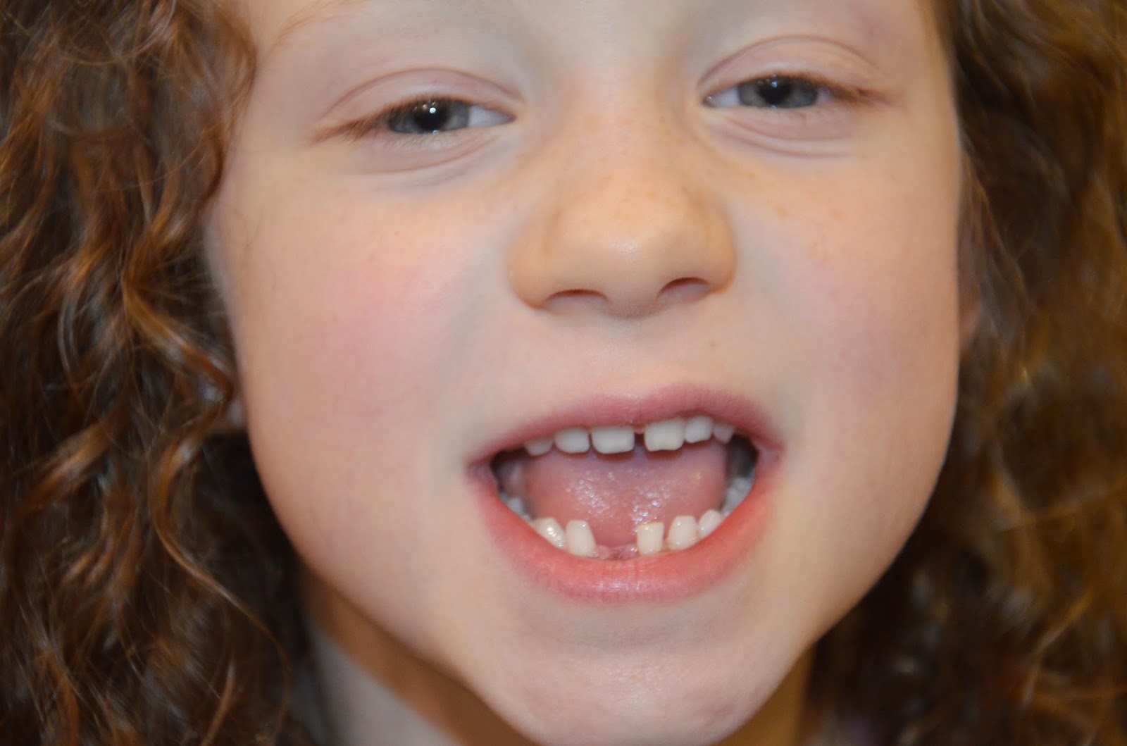 This Crazy Life!: My Baby's First Tooth