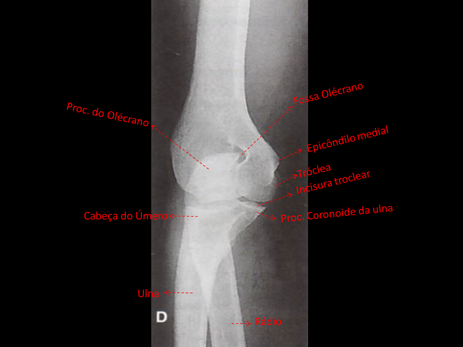 Laboratório de Roentgen: Membros Superiores Parte 2