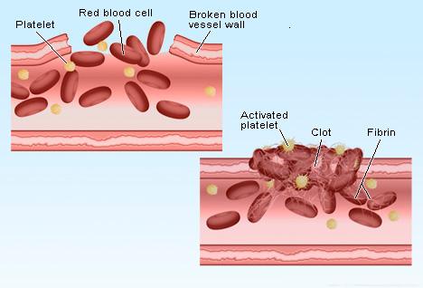 Manash (Subhaditya Edusoft): Blood and Immunity : Defence System ...