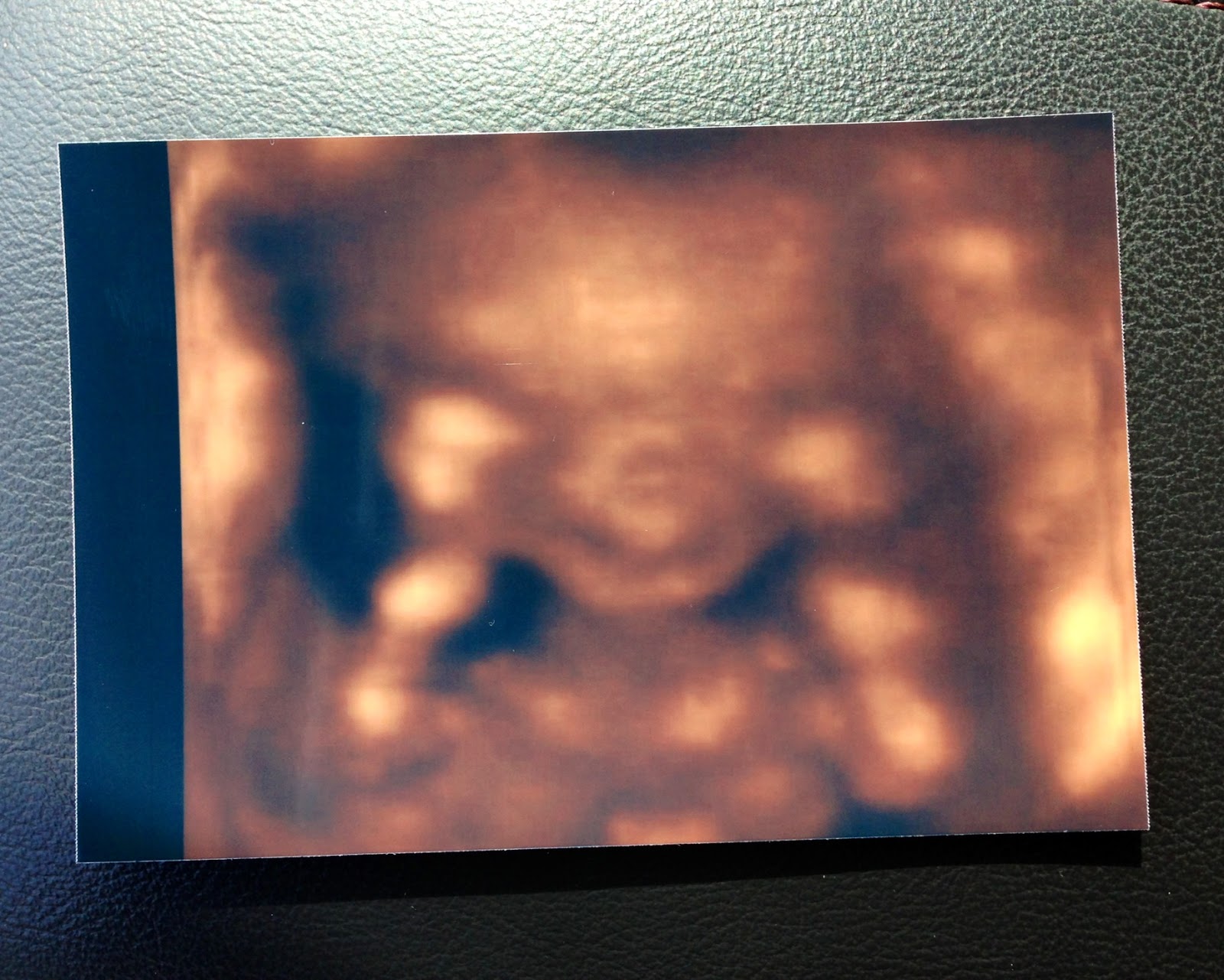 Little Baby Moon: 16 weeks & a GENDER ULTRASOUND!