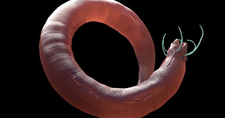 Man's intestinal tapeworm disappointed by man’s unadventurous diet ...