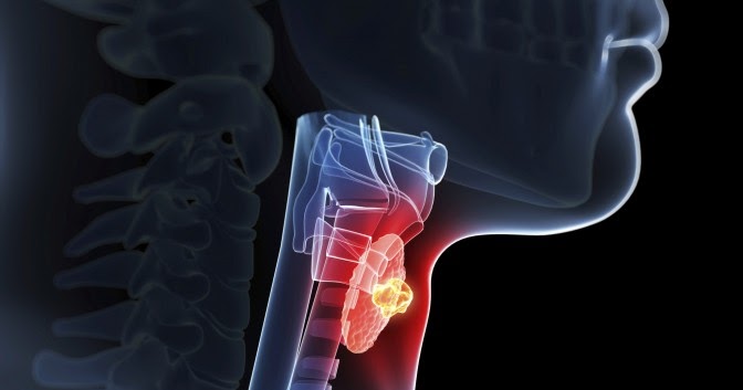 6 Tanda Penyakit Tiroid Yang Mungkin Anda Tidak Tahu ~ Tiroid dan Anda