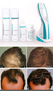 Hairmax Lasercomb Reviews