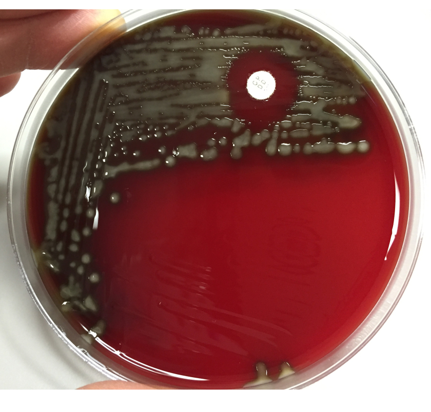 OPTOCHIN TEST - Microbiology Laboratory Turkey