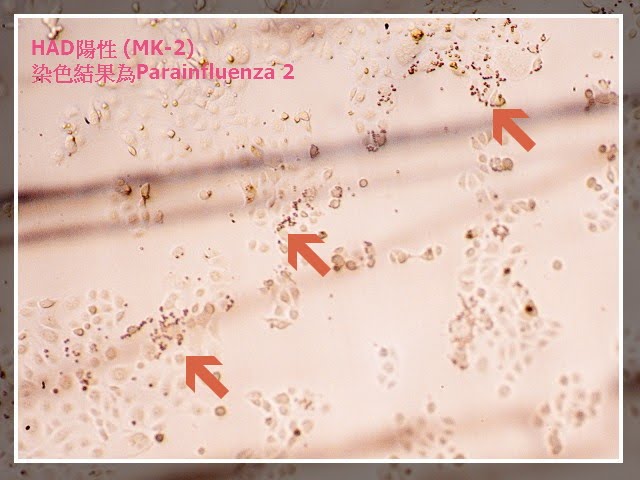 努力不一定會成功, 但成功一定需要努力!: 血球吸附試驗 (hemadsorption test, HAd)