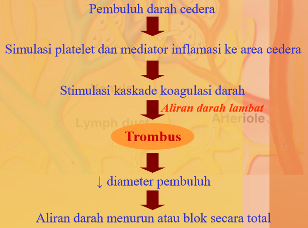 KNOWLEDGE: TROMBUS