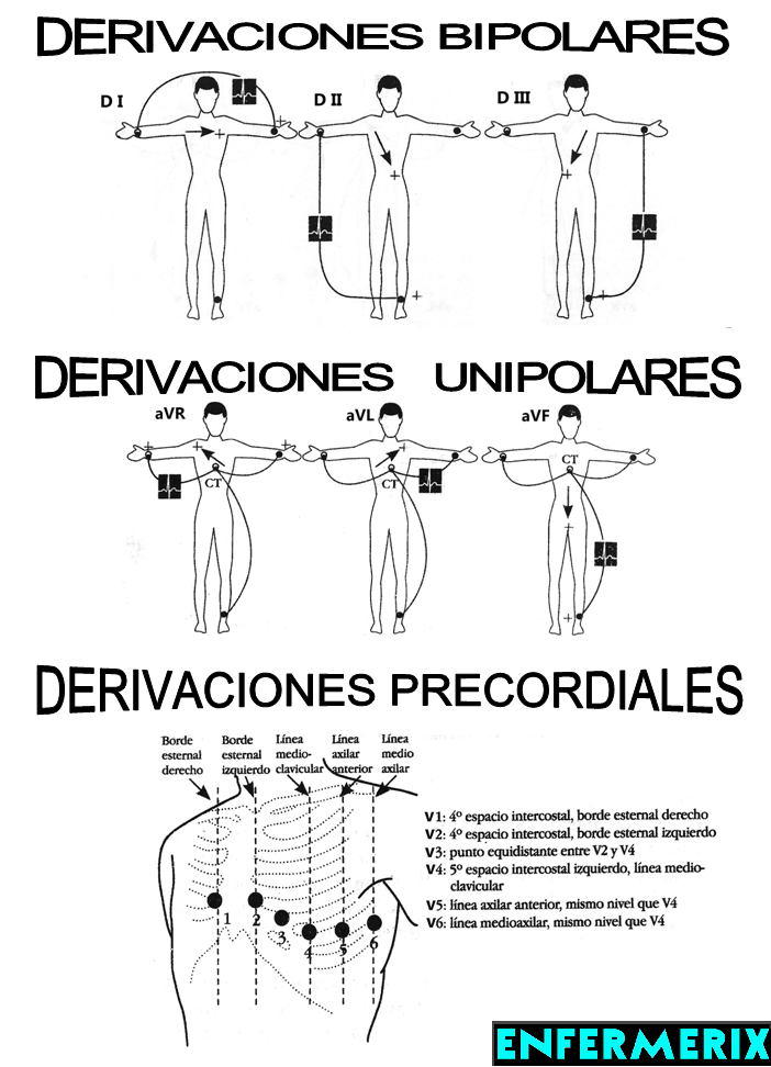 ENFERMERIX: ELECTROCARDIOGRAMA: LOCALIZACIÓN ANATÓMICA DE LOS ...