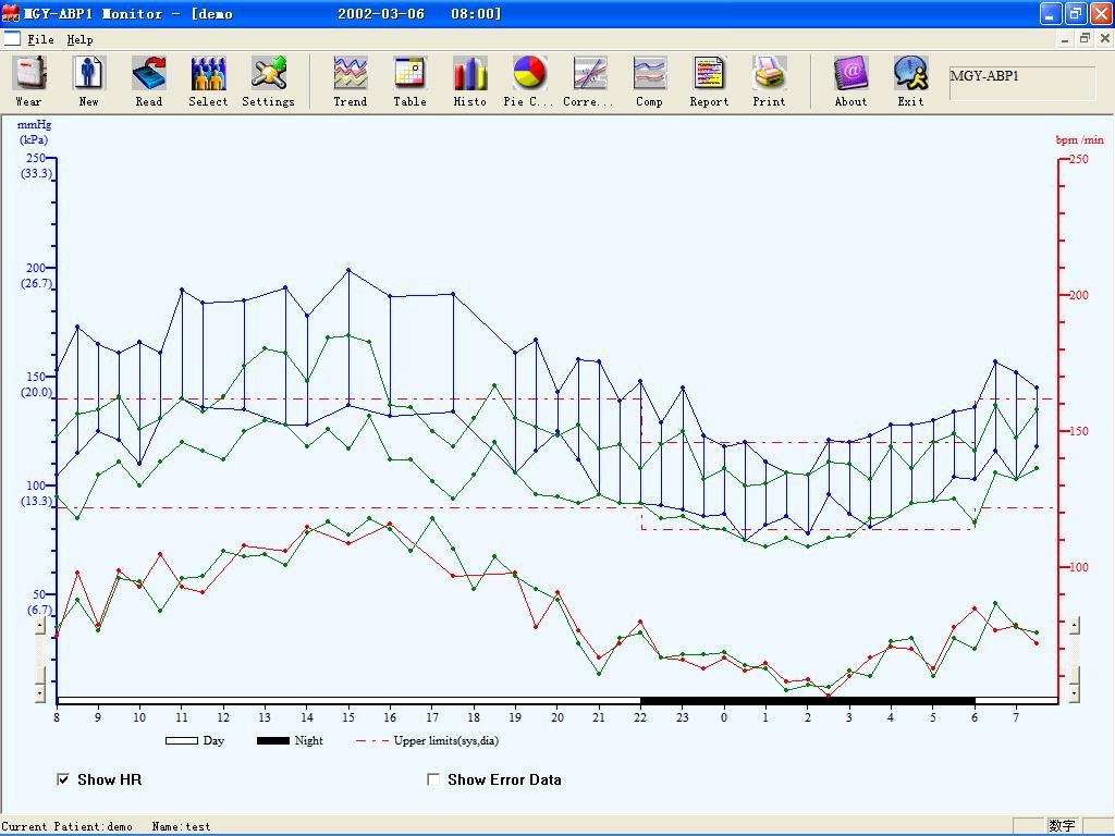 ¿Un MAPA de presión arterial? (alias monitoreo ambulatorio) 7 preguntas ...