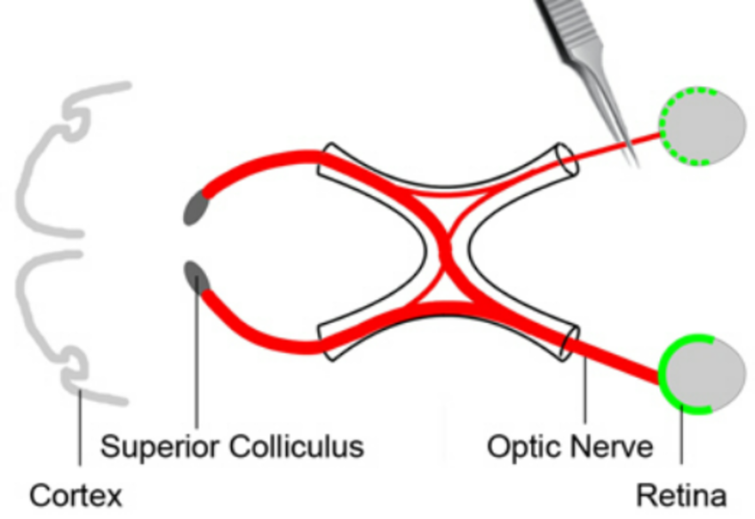 FIRST EVER VISION RESTORATION AFTER OPTIC NERVE INJURY IN MICE ...