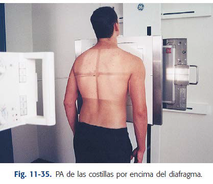 PRODUCCION Y TRATAMIENTO DE IMAGENES DIAGNOSTICAS: CAPITULO TÓRAX OSEO ...