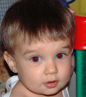 BioLOG: The Red Eye Effect