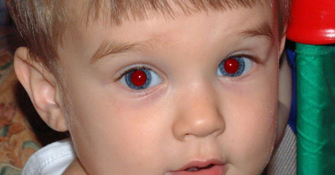 BioLOG: The Red Eye Effect