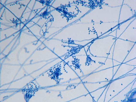 Fun With Microbiology (What's Buggin' You?): Paecilomyces lilacinus