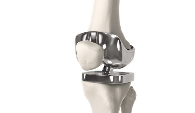 ERGONOMICS GUIDE: CHRONIC KNEE PAIN