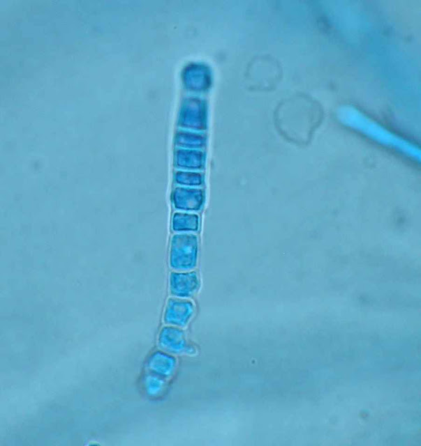 ATLAS MICOLOGIA: NEOSCYTALIDIUM HYALINUM