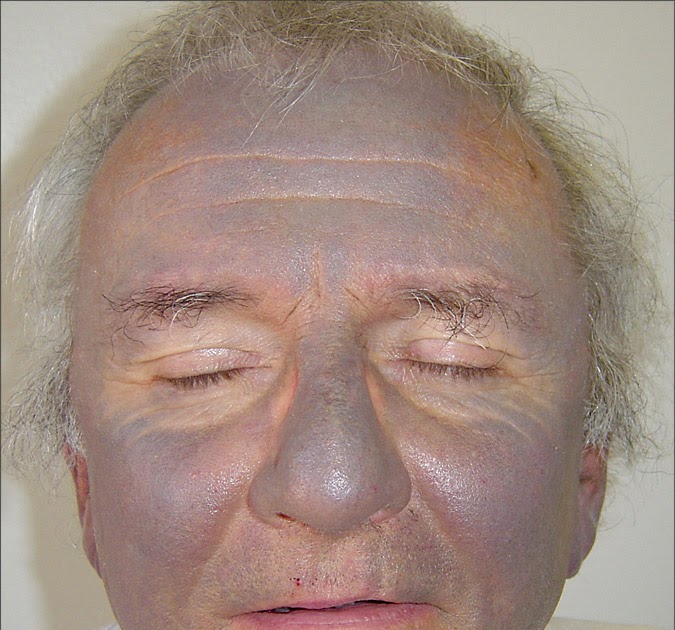 Case of the Day: Blue Man Group