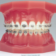 Dr William Thomas' Orthodontic Blog