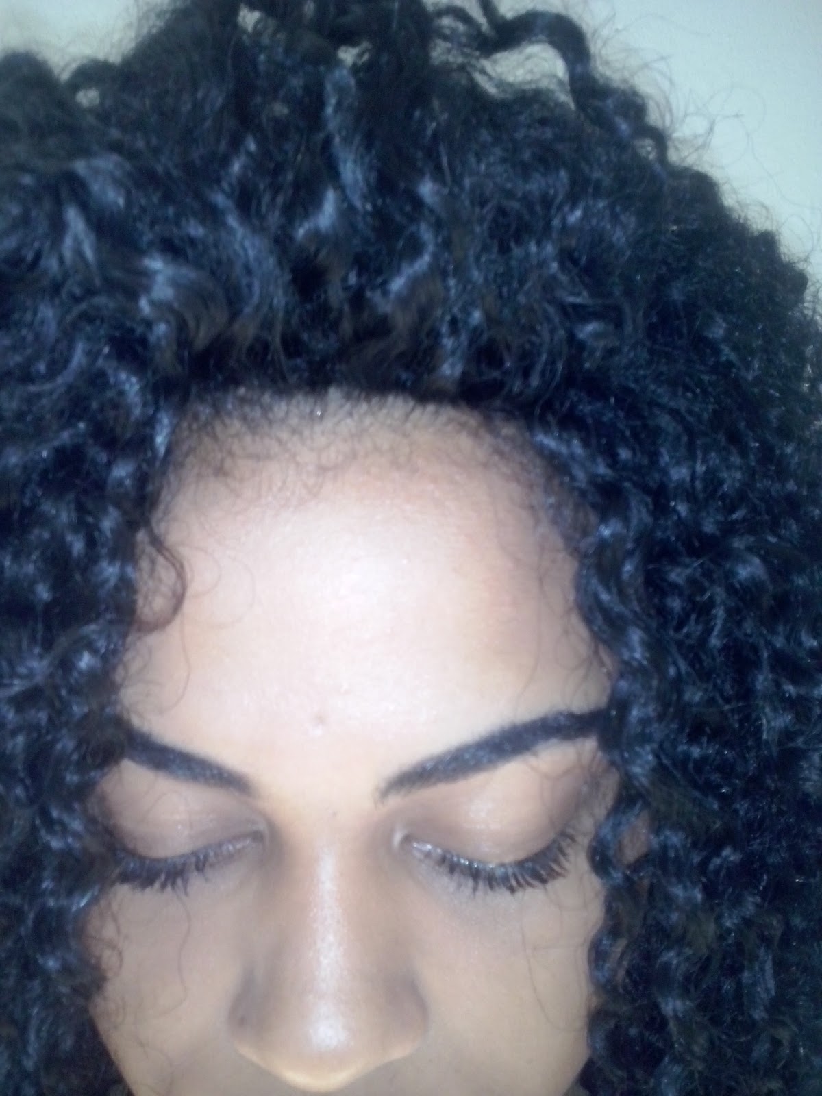 Tipos de acabamentos de frente e franja (Próteses móveis e fixas)