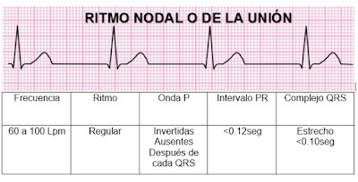 ELECTROCARDIOGRAFÍA BÁSICA PARA ENFERMERÍA: RITMO EN UN ELECTROCARDIOGRAMA