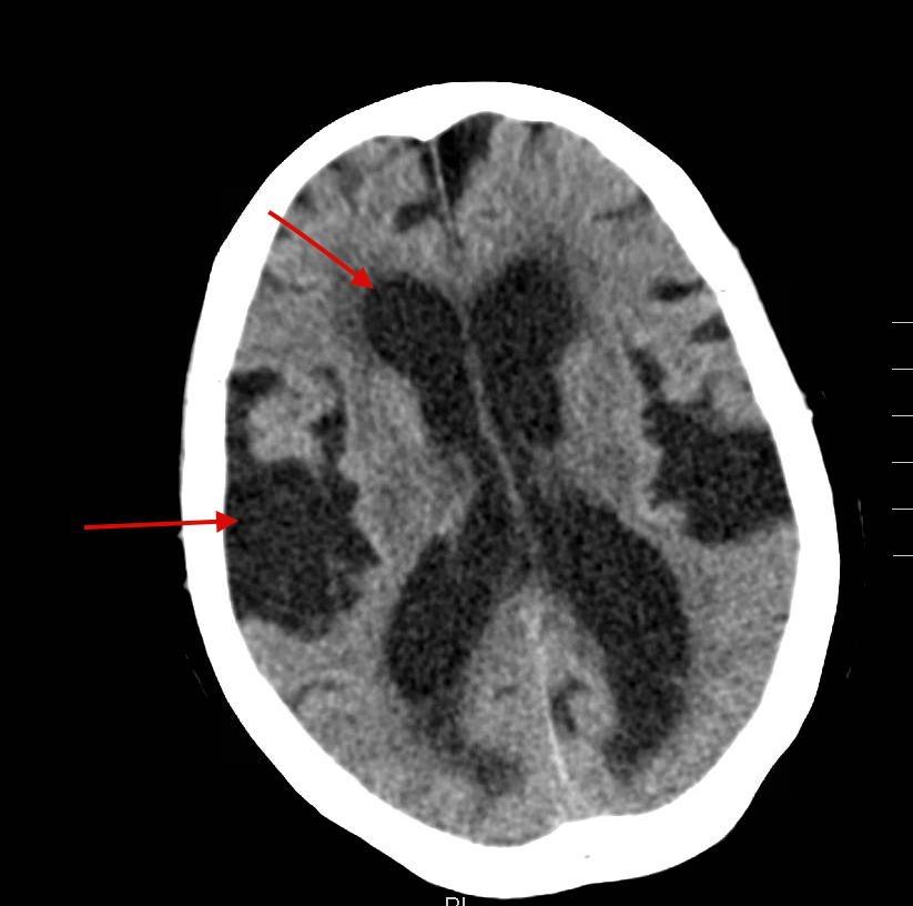 Cases and Images in Infectious Disease