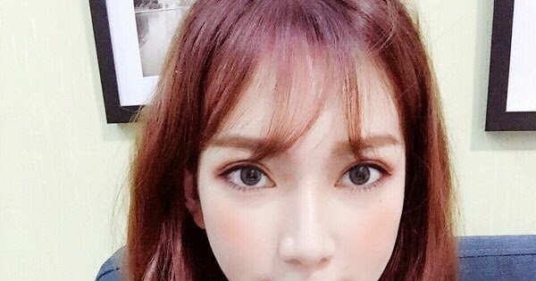 TL PLASTIC SURGERY CLINIC KOREA: No more flat&sunken forehead!! TL ...