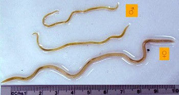 Microcrobium: Ejemplos clinicos de HELMINTOS